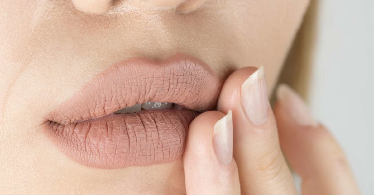 Candidiasis On Lips Treatment | Lipstutorial.org