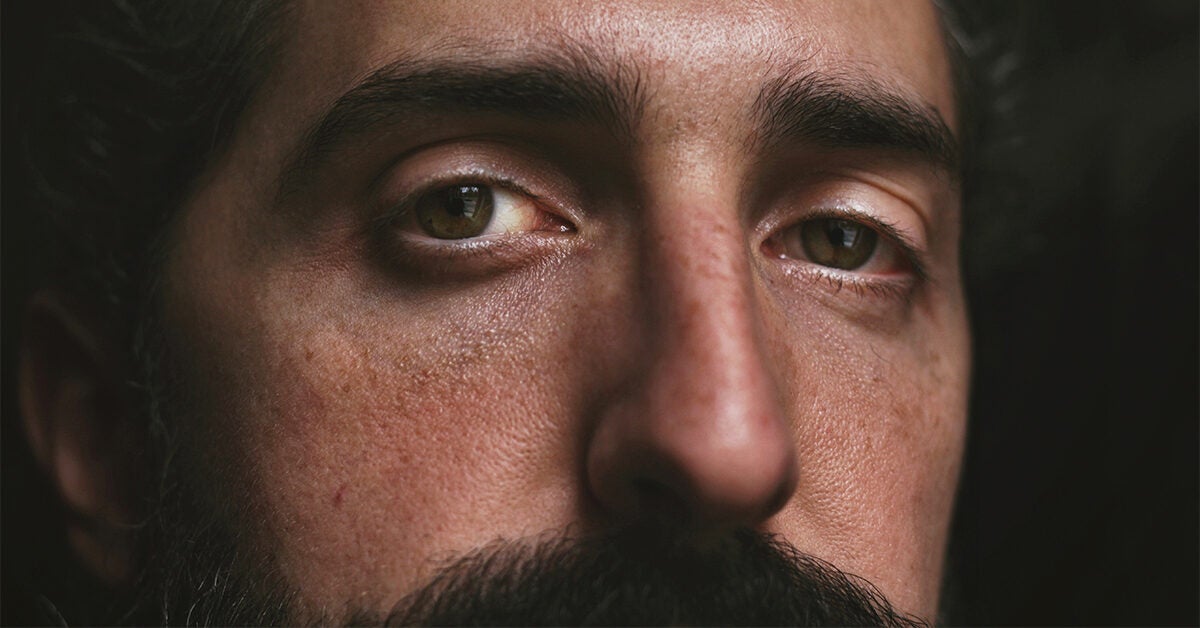 Can You Become Addicted to Fentanyl?