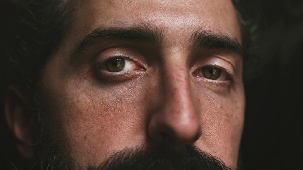 Can You Become Addicted to Fentanyl?