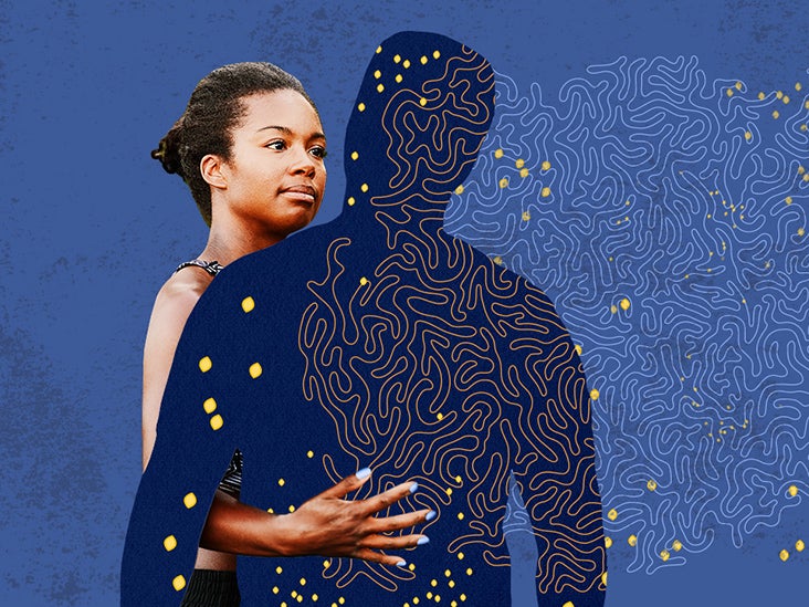 Capgras Syndrome: Causes, Symptoms, Risks, and Treatment